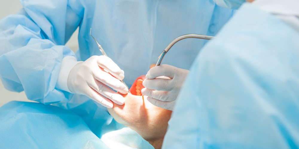 Tooth Extraction in Auburn, CA | North Auburn Dentistry | Dentist CA 95603